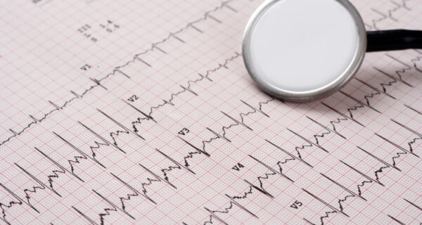 10 Best EKG Books for Nurses and Nursing Students - Nurse Money Talk
